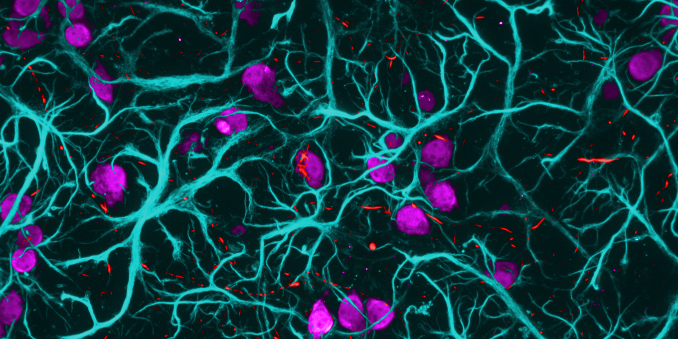 Neurodegeneration - Cellectricon