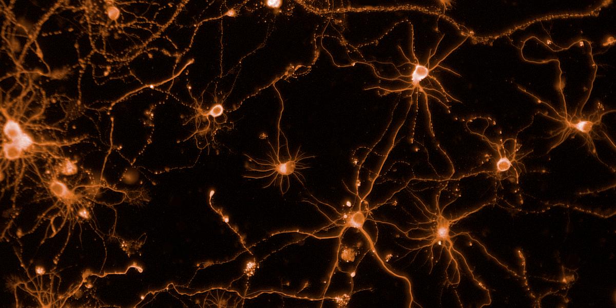 Neuroplasticity - Cellectricon