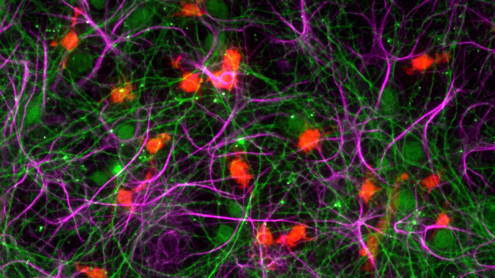 Neuroinflammation - Cellectricon